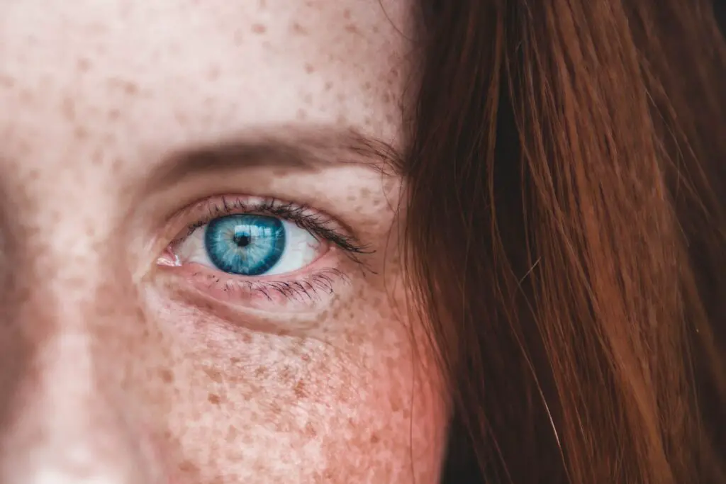 How rare is it to be ginger with blue eyes?