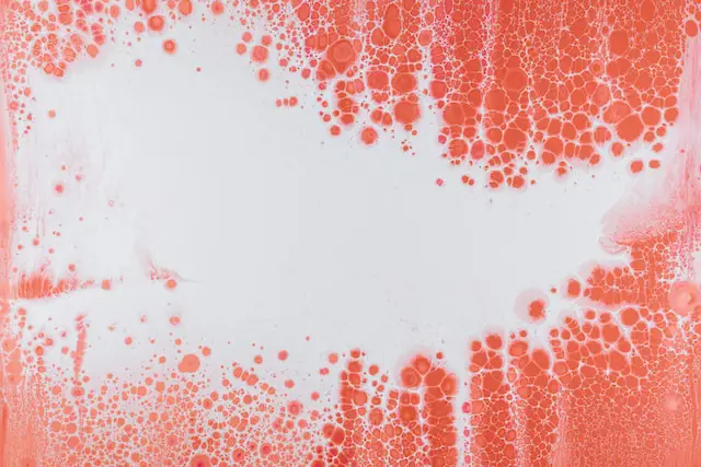 Why is my ingrown hair bleeding?