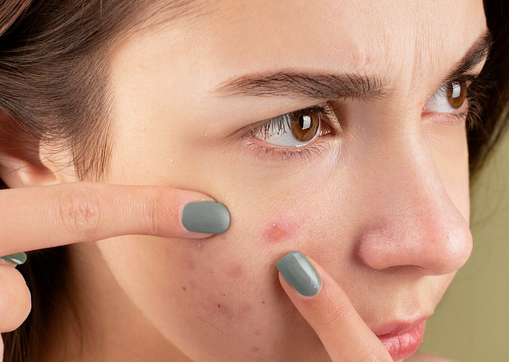 Is it Normal for a Boil to Turn Purple? - Gek Buzz