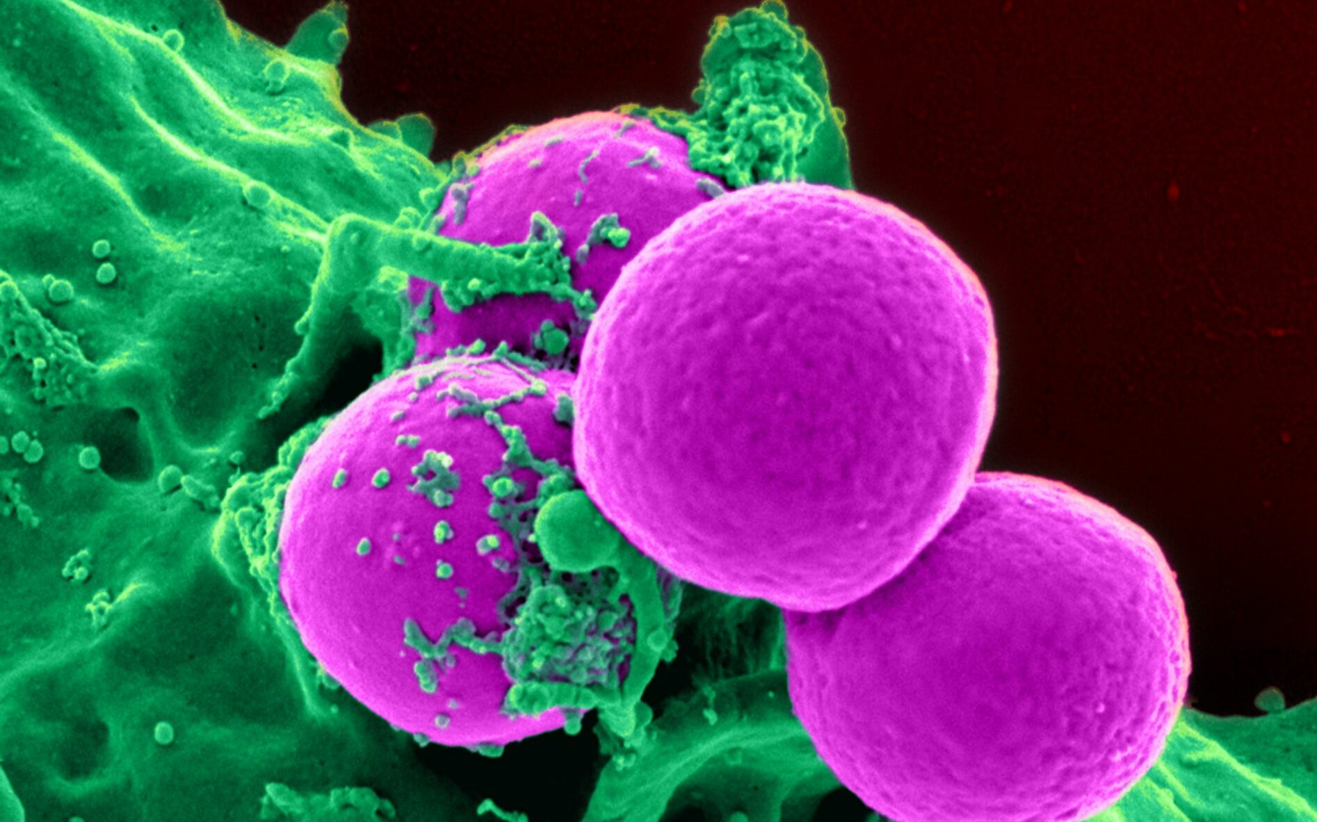 How do cancers act when they are mad?